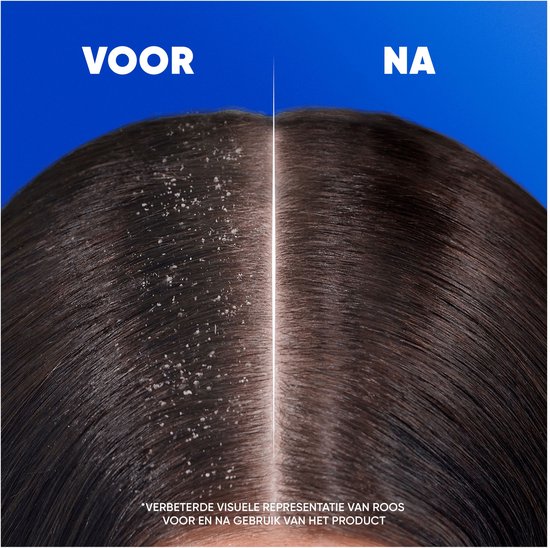 Head & Shoulders Shampoo 400 ml Apple Fresh - Velora Drogisterij